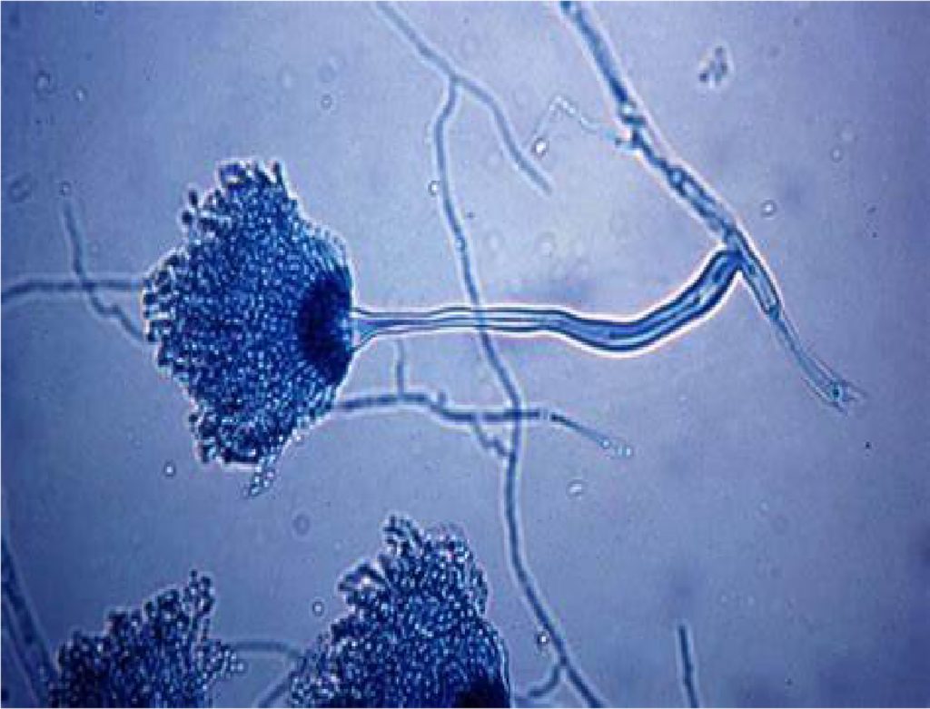Aspergillus – Clínica de Alergia y Pediatría