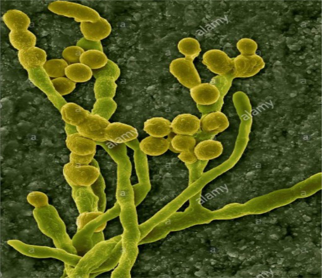 Hormodendrum – Clínica de Alergia y Pediatría